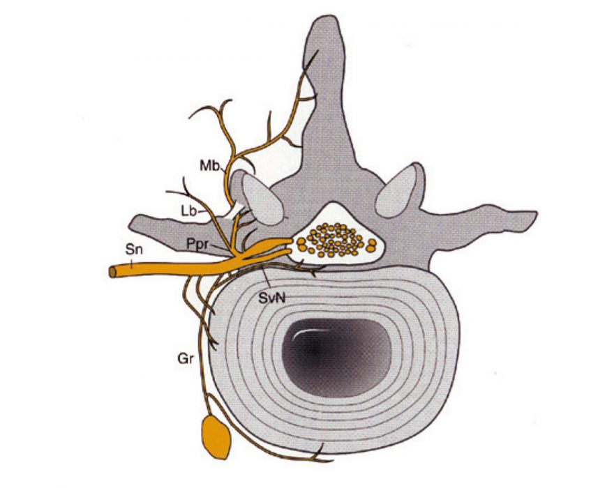 CT gesteuerte Schmerztherapie